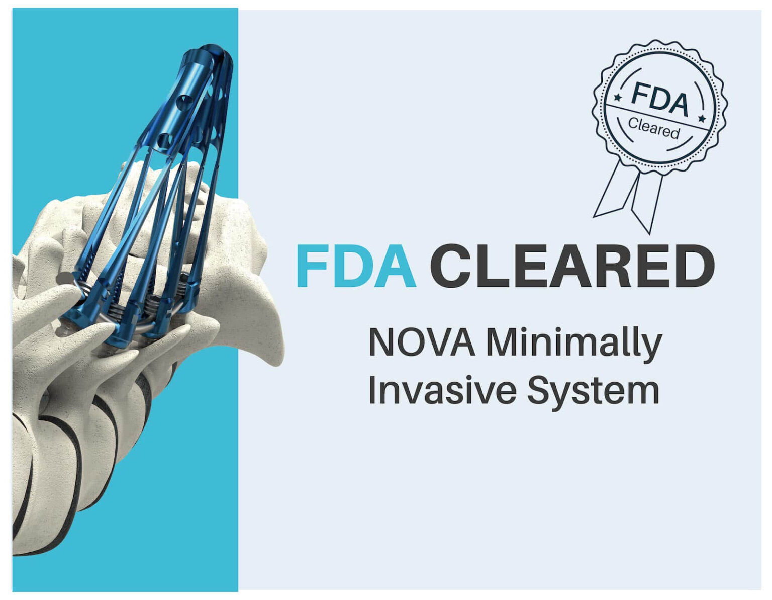 FDA Approves NOVA MIS System | BAUI Biotech