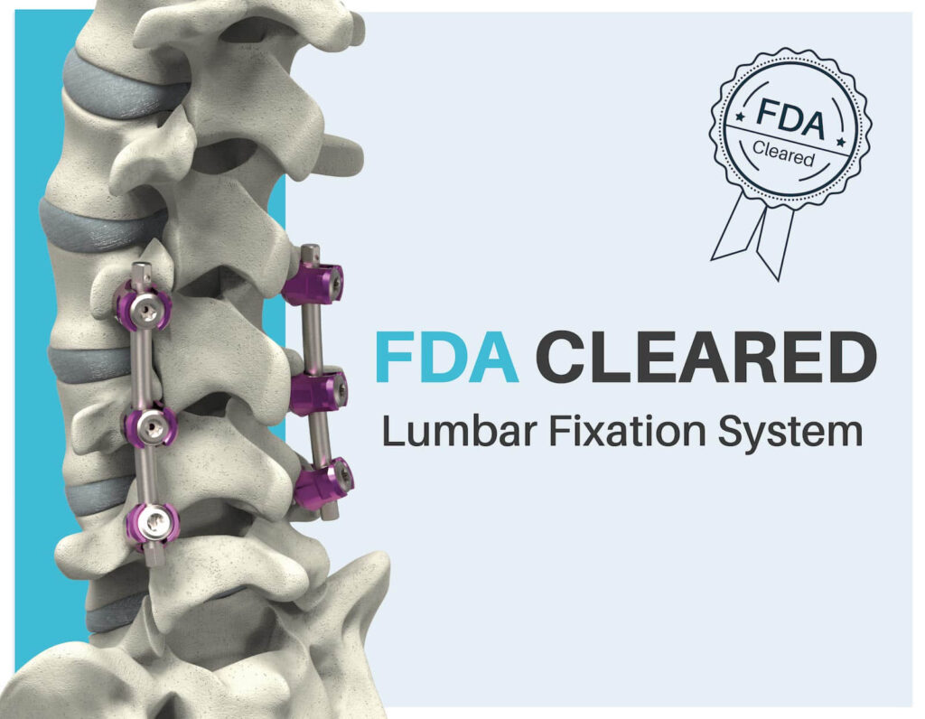 FDA Approves Lumbar Fixation System | BAUI Biotech