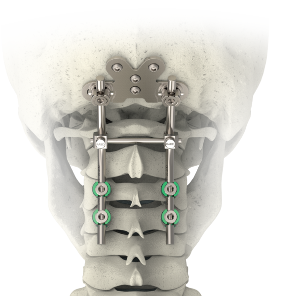 Posterior Cervical Fixation System | BAUI Biotech