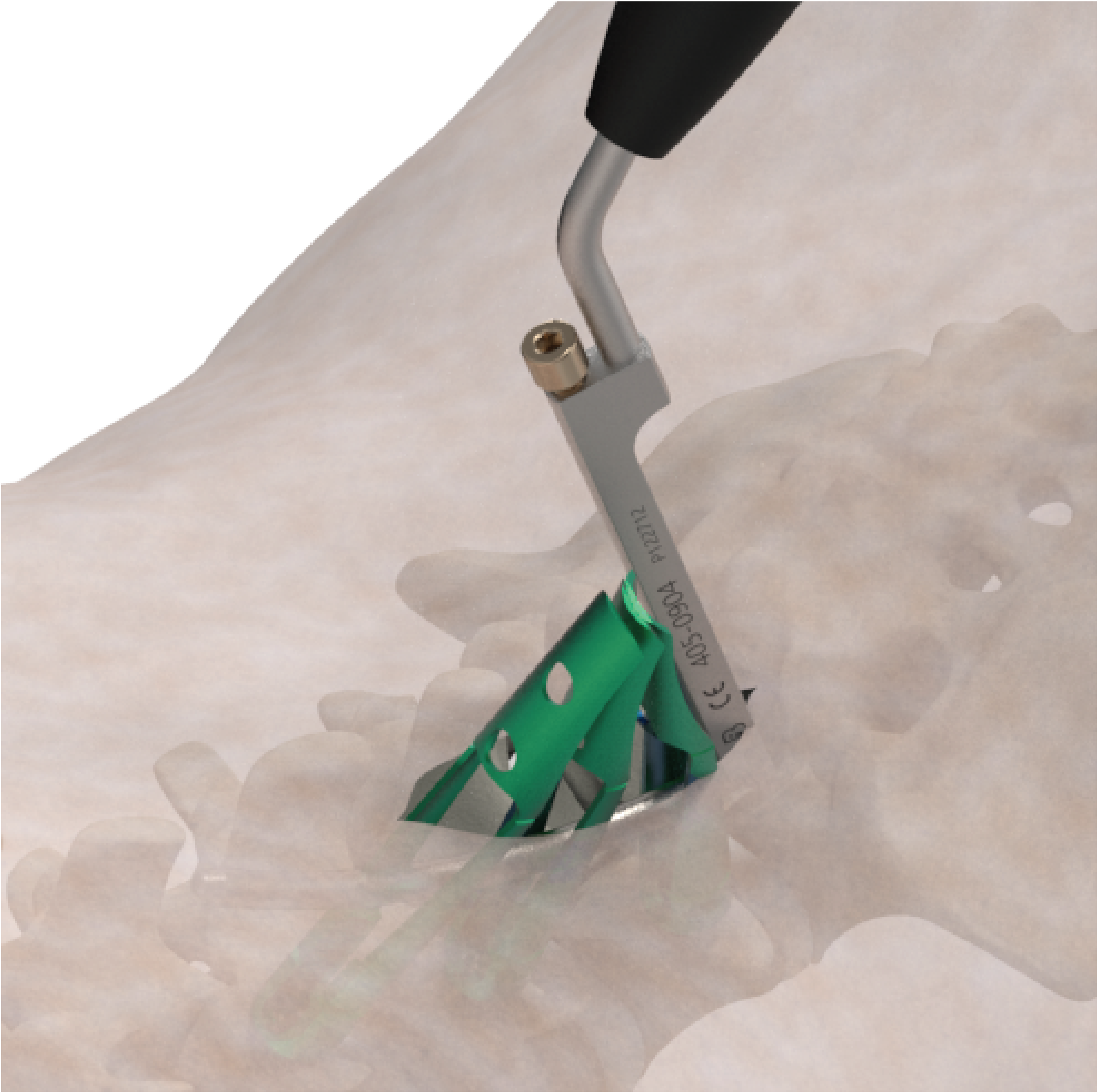 NOVA 2 Minimally Invasive System | BAUI Biotech