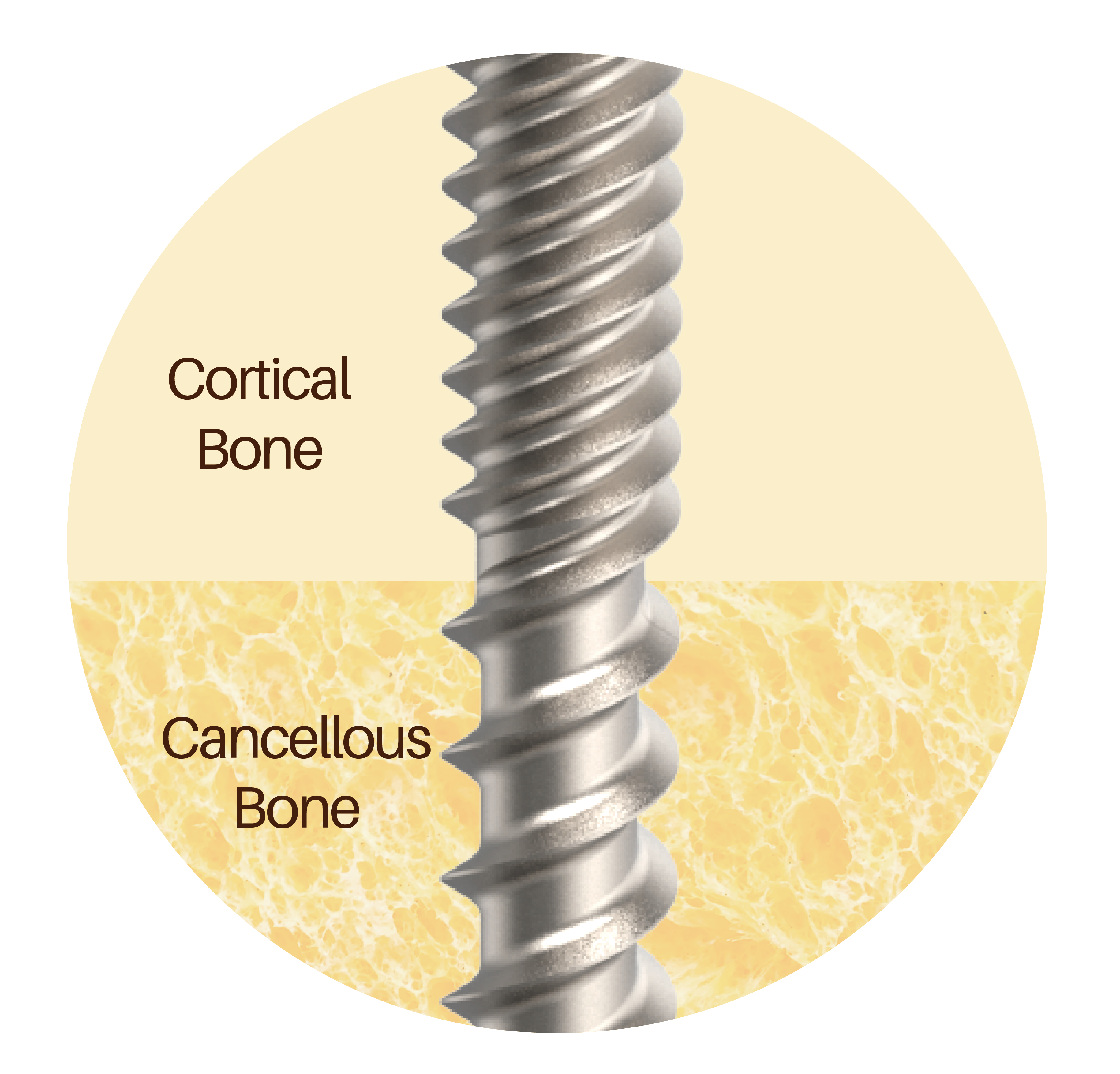 NOVA 2 Minimally Invasive System | BAUI Biotech